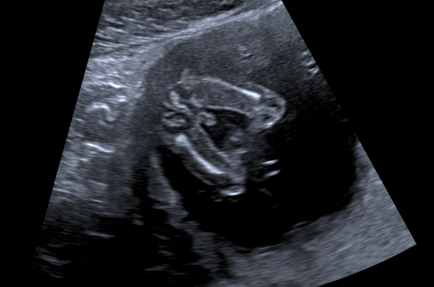 Pretecho - Pretecho Little one